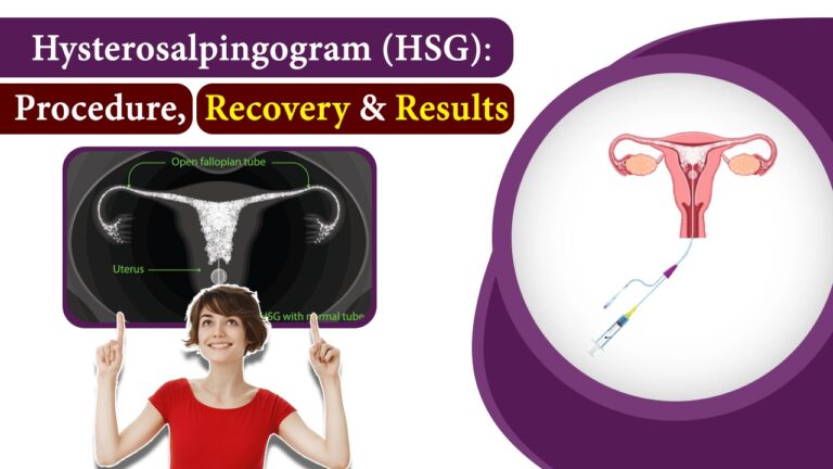 What is Hysterosalpingogram Test (HSG test): Procedure, Recovery ...